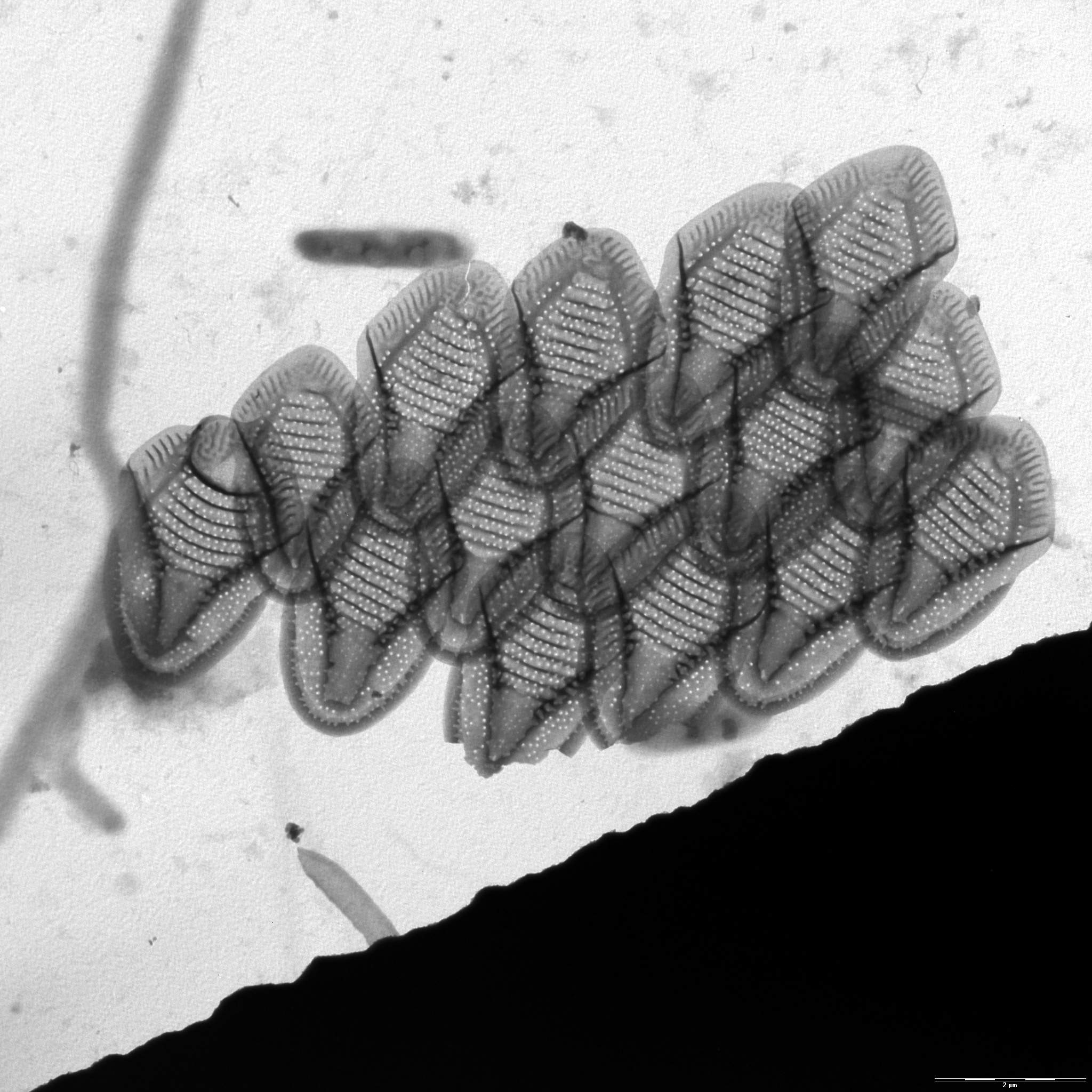 Mallomonas actinoloma var. maramuresensis | Silica-scaled chrysophytes ...